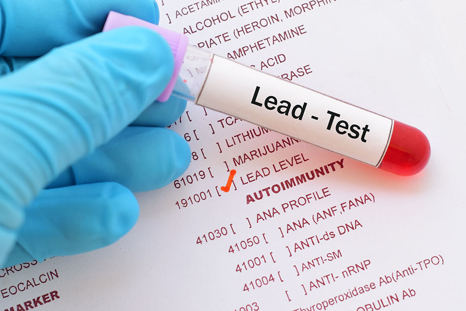 Maryland Court Addresses Time On The Risk Allocation For Lead Injury ...